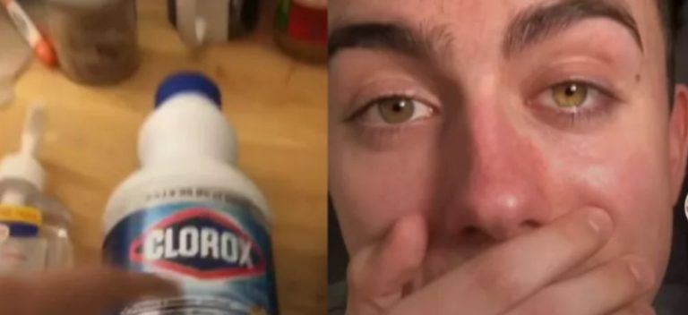 TikTok Challenge Goes Viral As Teens Press Bleach Packets On Their Eyes ...