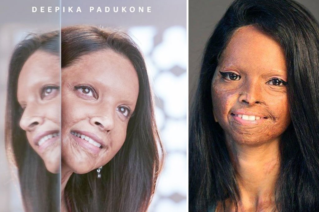 deepika-chapak-first-look - ED Times | Youth Media Channel