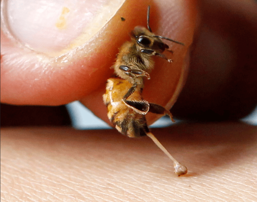 Study Reveals Honeybee Venom Can Cure 2 Types Of Breast Cancer Easily ...
